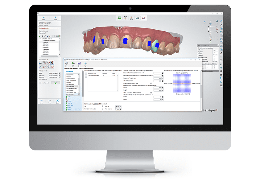 3Shape Clear Aligner Studio Software